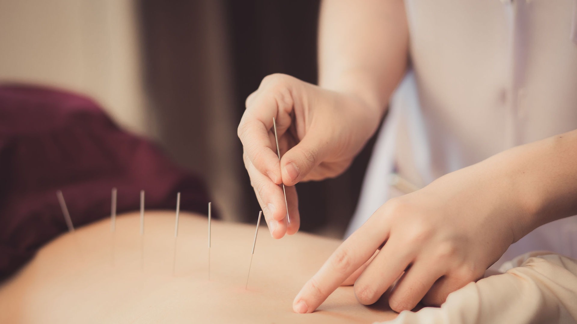 Rates - Denver Community Acupuncture